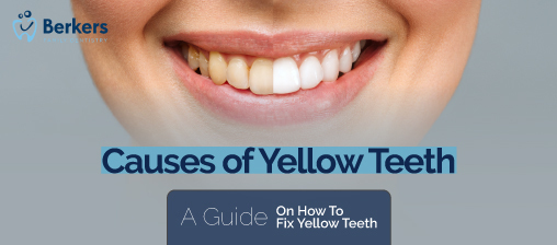 Causes of yellow teeth | Schmidt & Berkers Family Dental
